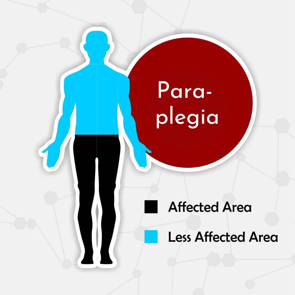 What are the Paralysis Recovering Chances ? - Care24